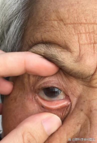 70岁老人眼睛看东西有黑点图标