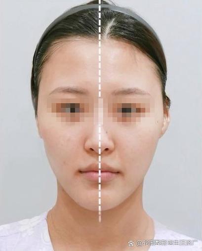 拍照脸歪照镜子脸不歪图标