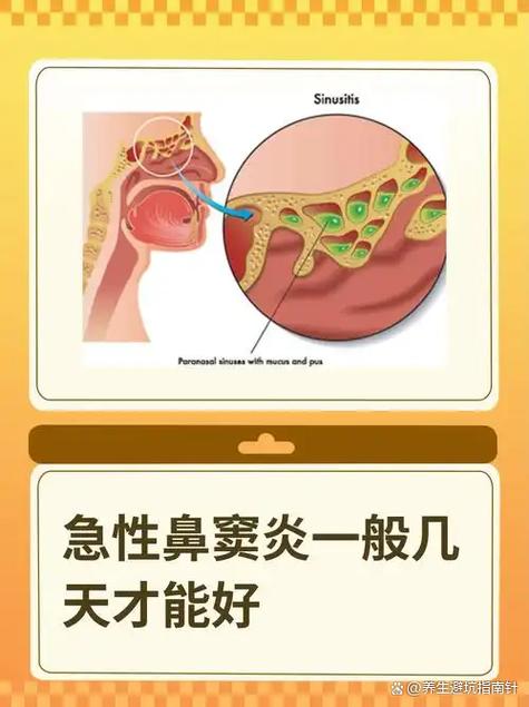 鼻炎和鼻窦炎图片图标