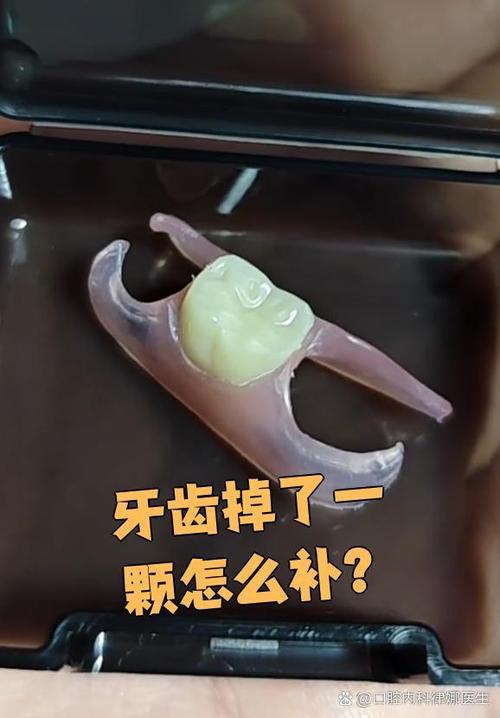 牙掉了一颗怎么处理最好图标
