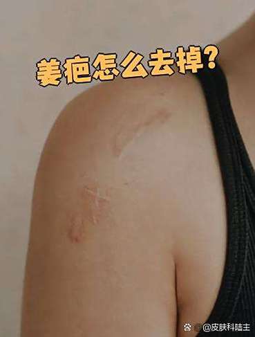 疤痕皮肤图标