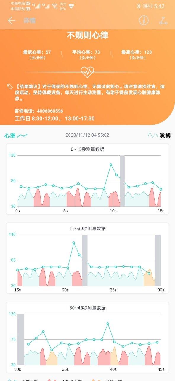 华为手环不规则心率代表什么截图