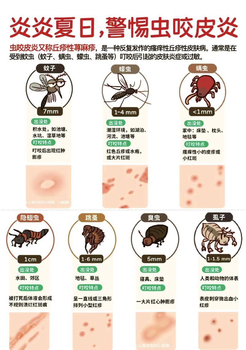 咬昆私是什么意思