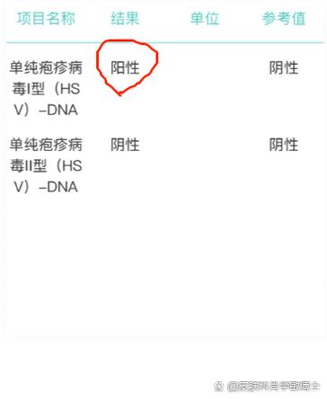 感染病毒能自愈吗图标