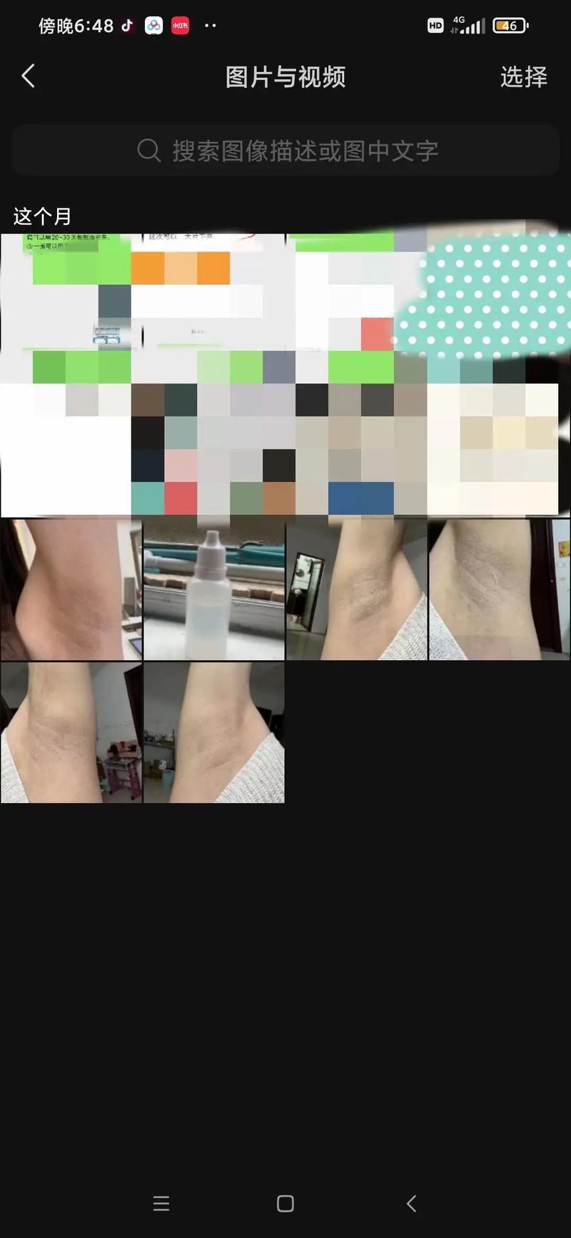 腋窝有黑色斑块是怎么回事截图