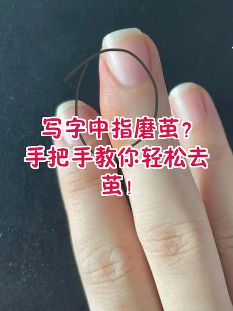 去除手上茧子小妙招图标