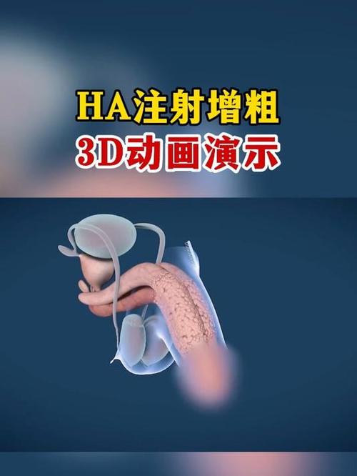 增大增粗小广告图标