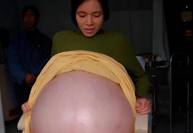 怀孕寄生肚子变大图标