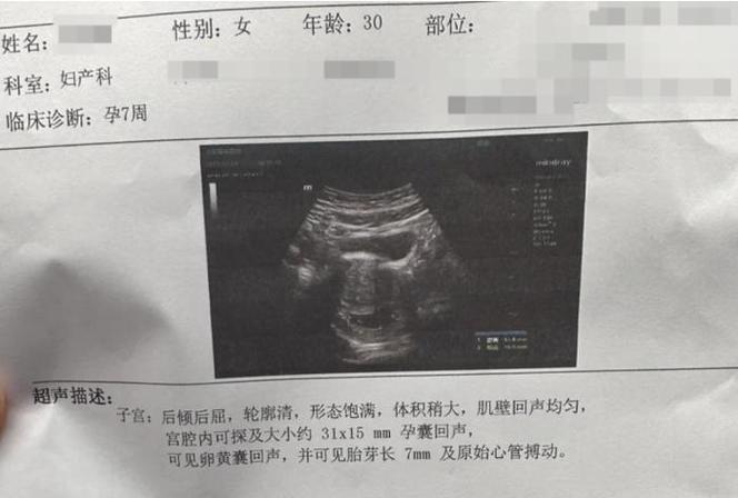 怀孕b超图片在线生成器截图