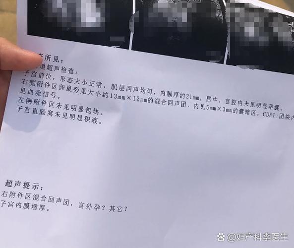 液性暗区排除出截图