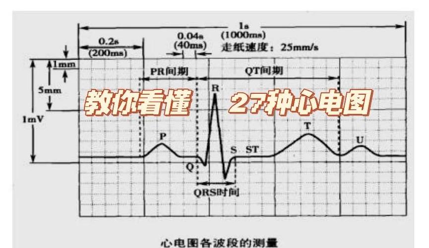 华为手表心电图波形图解游戏截图