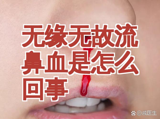 无缘无故流鼻血是怎么回事图标