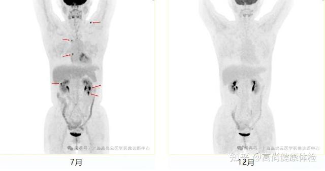 xthz路pet的特点