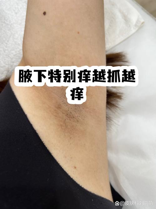 腋下痒痒越抓越痒图标