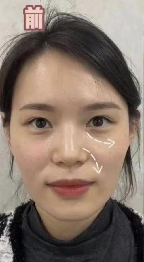 皮肤松弛下垂怎么改善图标