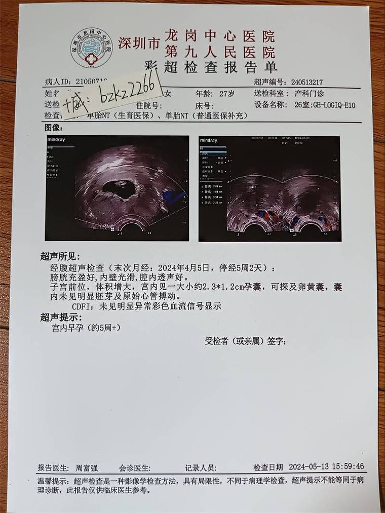 b超afi是什么意思图标