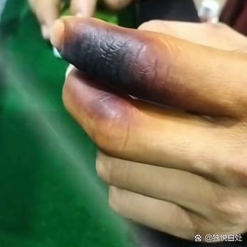 手机屏幕手指划过有深色痕迹截图