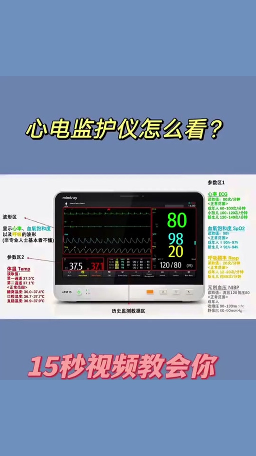 如何看懂监护仪上的参数图标
