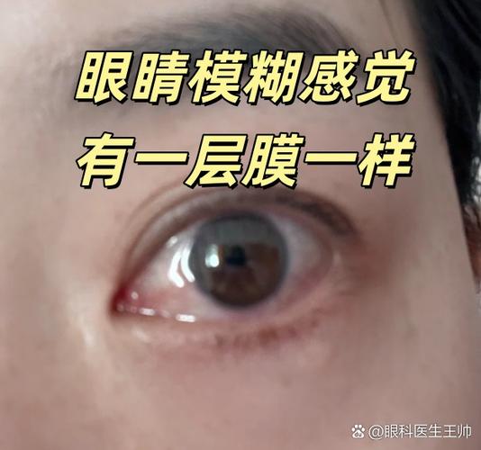 眼睛有一层蒙是什么原因图标
