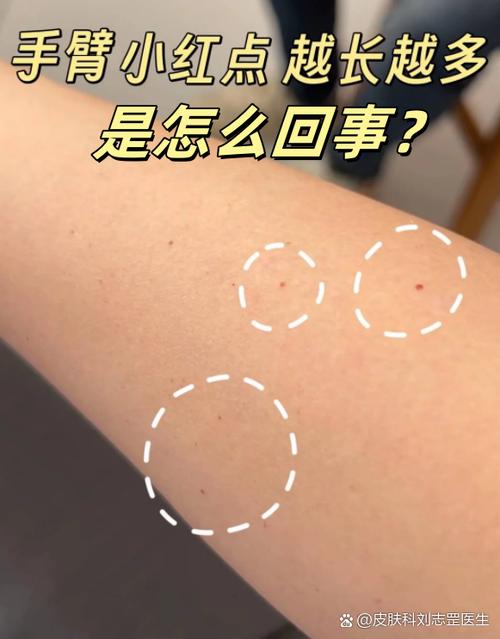 针尖大小红点图片截图