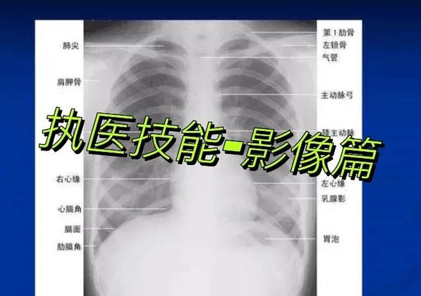 CAT与CT检查区别游戏截图