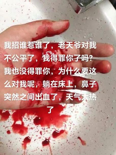 流鼻血和玩手机有关系吗图标