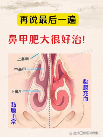 滞后性对生活的影响图标