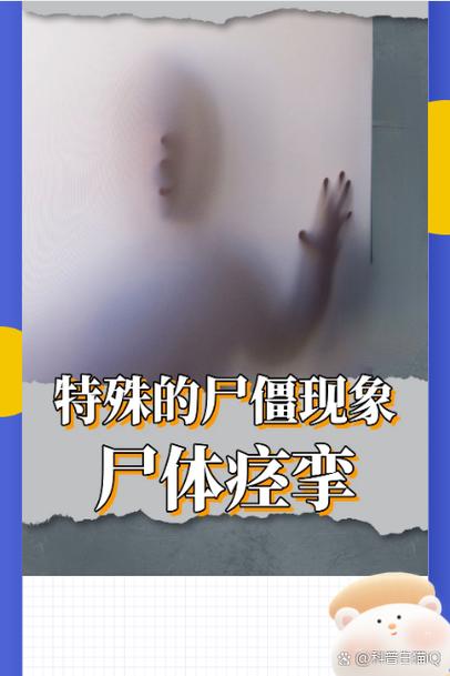 人去世身体僵硬多少个小时能变软截图