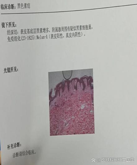 皮肤上有凸起的小疙瘩图标