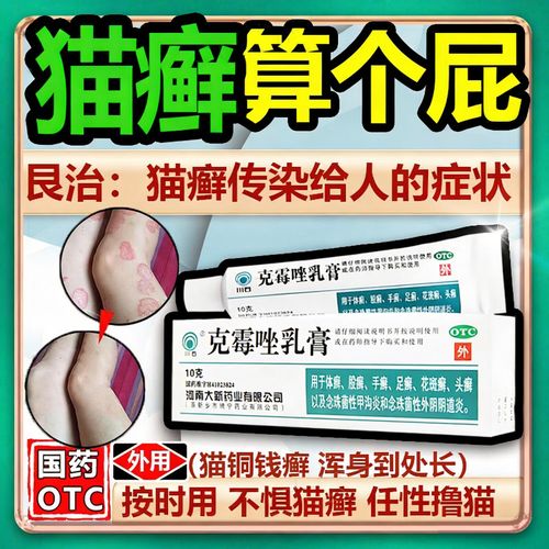 人得猫癣涂什么好得快图标