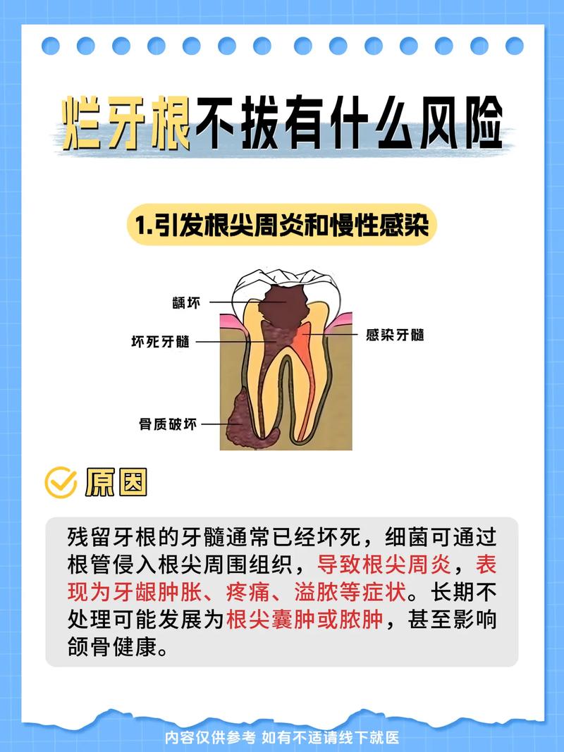 蛀牙松动不拔有危害吗截图