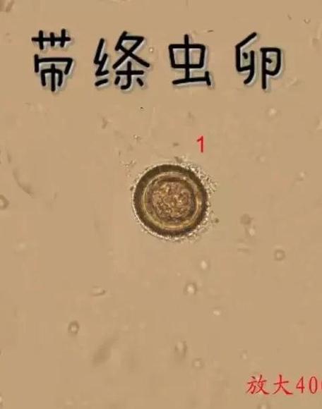 口红寄生虫从屁股钻进去寄生图标