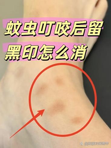 橡皮在纸上留下黑印图标