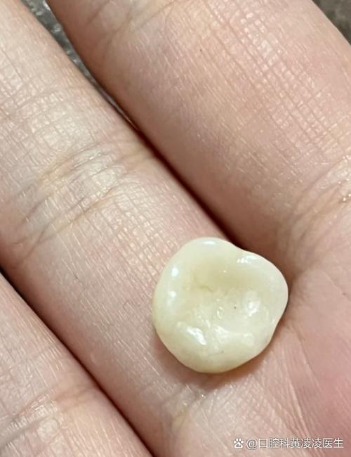 牙齿碎了一半要拔掉吗图标