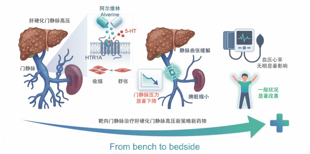 门脉高压诊断标准