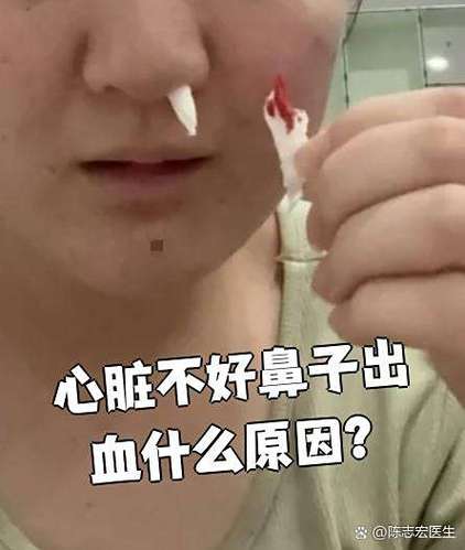 右边鼻孔老是流鼻血是怎么回事图标