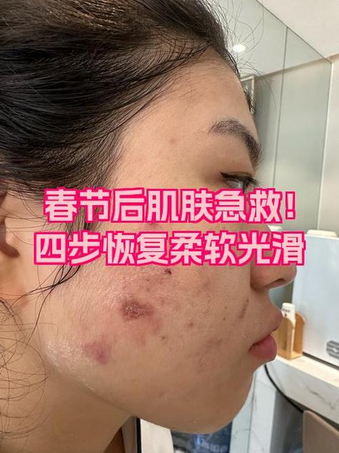 脸过敏发红发痒眼睛肿图标