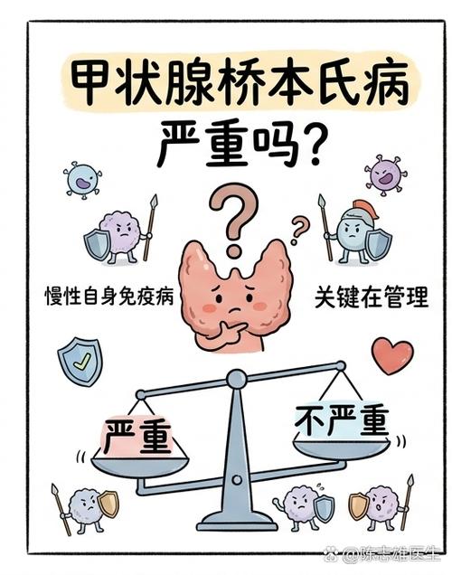 甲状腺桥本氏病严重吗图标