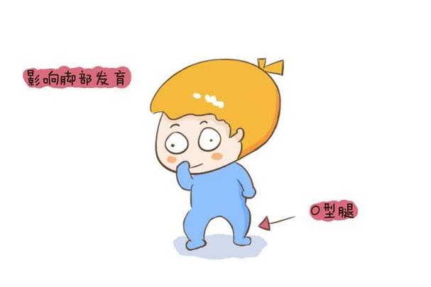 交叉蹬腿综合症图标