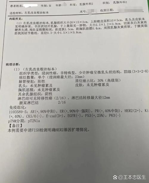 病理良性就不通知吗
