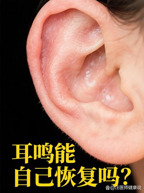 耳鸣会自己恢复正常吗图标