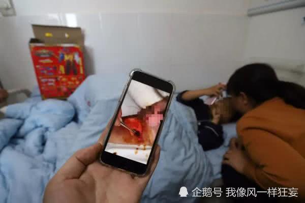 饭卡被热水烫了还能用吗图标
