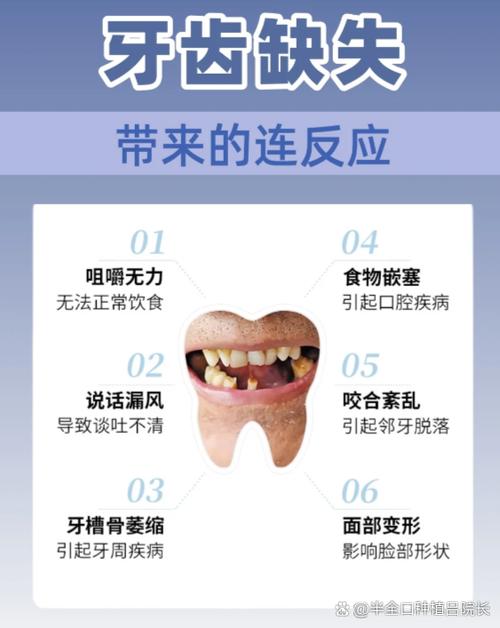 长期缺牙的危害有哪些图标