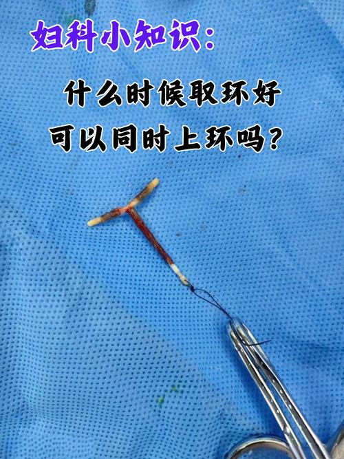 融环和炸环的区别图标