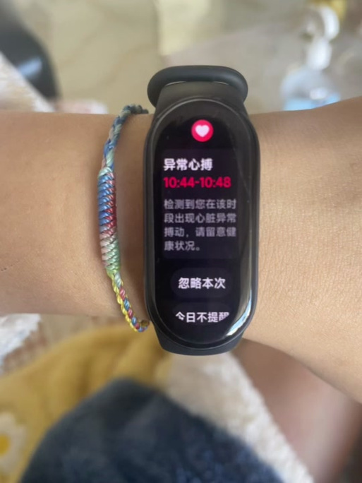 小米手环不提醒图标