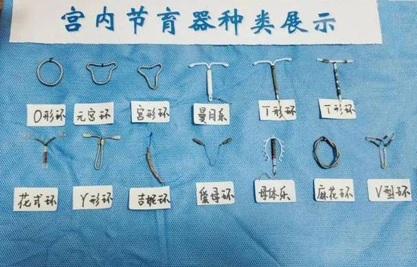 v型环可以戴几年截图
