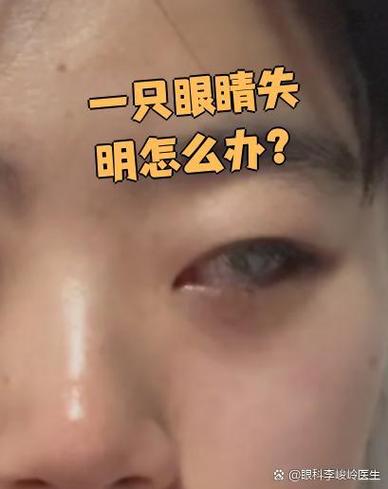 人眼睛瞎了能复明吗图标