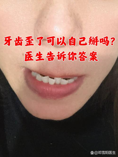 牙齿歪了可以自己掰吗