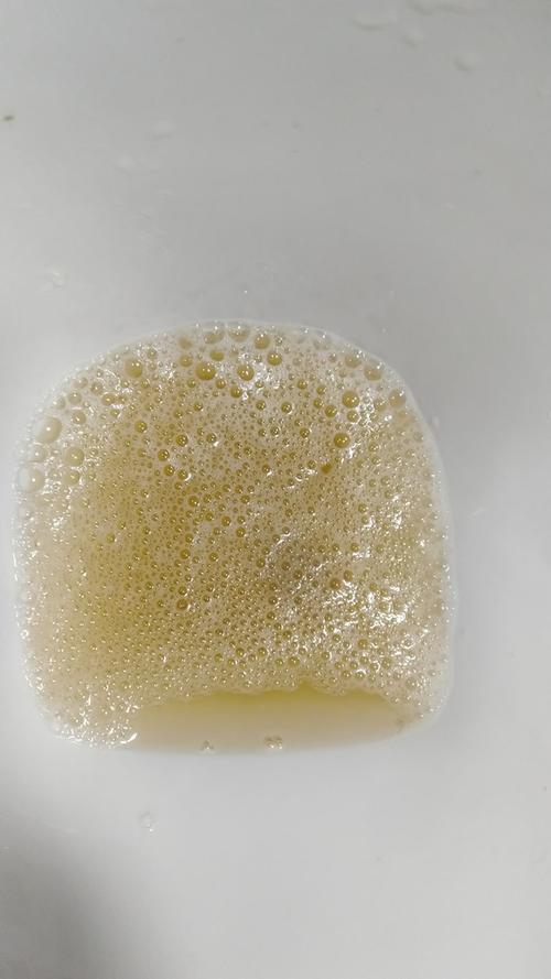 老年人尿有泡沫是病吗图标
