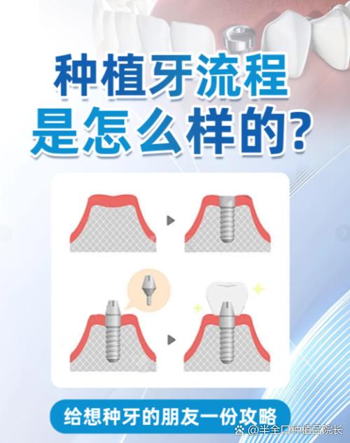 补大牙一般要多少钱一颗